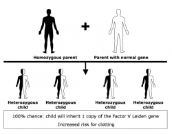Factor V Leiden - Blood Clots