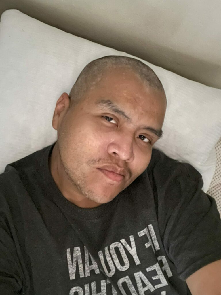 Nurses Say I’m a Miracle: Marcus’ Story