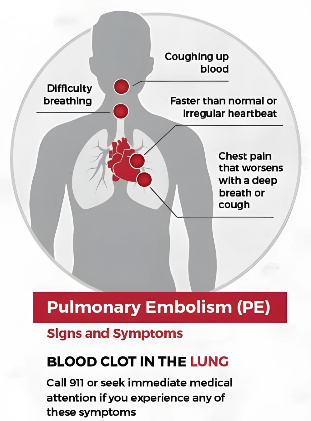 Signs and Symptoms of Blood Clots