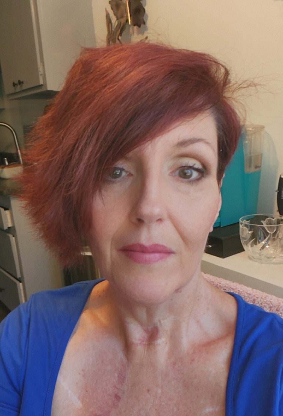 Abdominal Blood Clots Following Cancer Treatment: Tiffani's Story